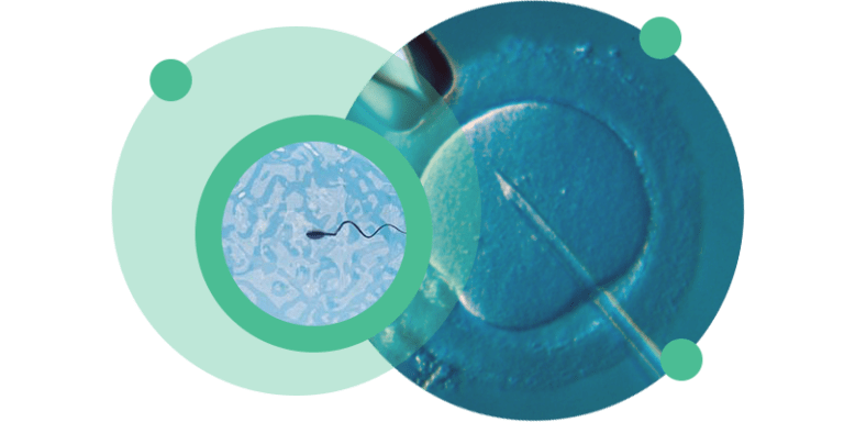 Microinjeção Intracitoplasmática de Espermatozoide (ICSI) - CETI